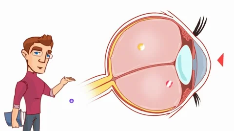 Eye Anatomy - Vector Cartoon - White Ba... | Stock Video | Pond5