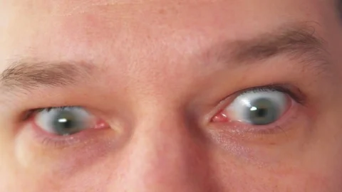 Eye movement. Eyes running from side to ... | Stock Video | Pond5