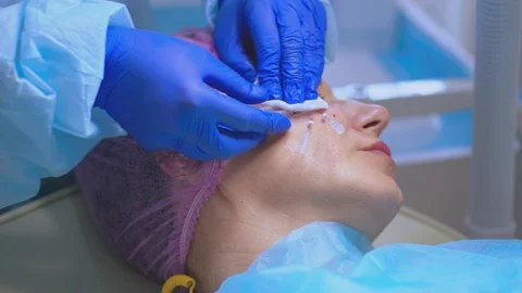 Face thread lifting procedure | Stock Video | Pond5