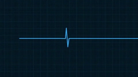 Fast Heartbeat Stock Footage ~ Royalty Free Stock Videos | Pond5