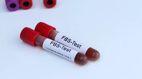 FBS test to look for abnormalities from ... | Stock Video | Pond5