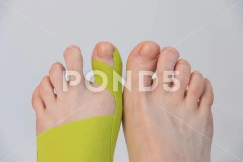 Photograph: Feet close-up, top view. There is a tap on the big toe ...