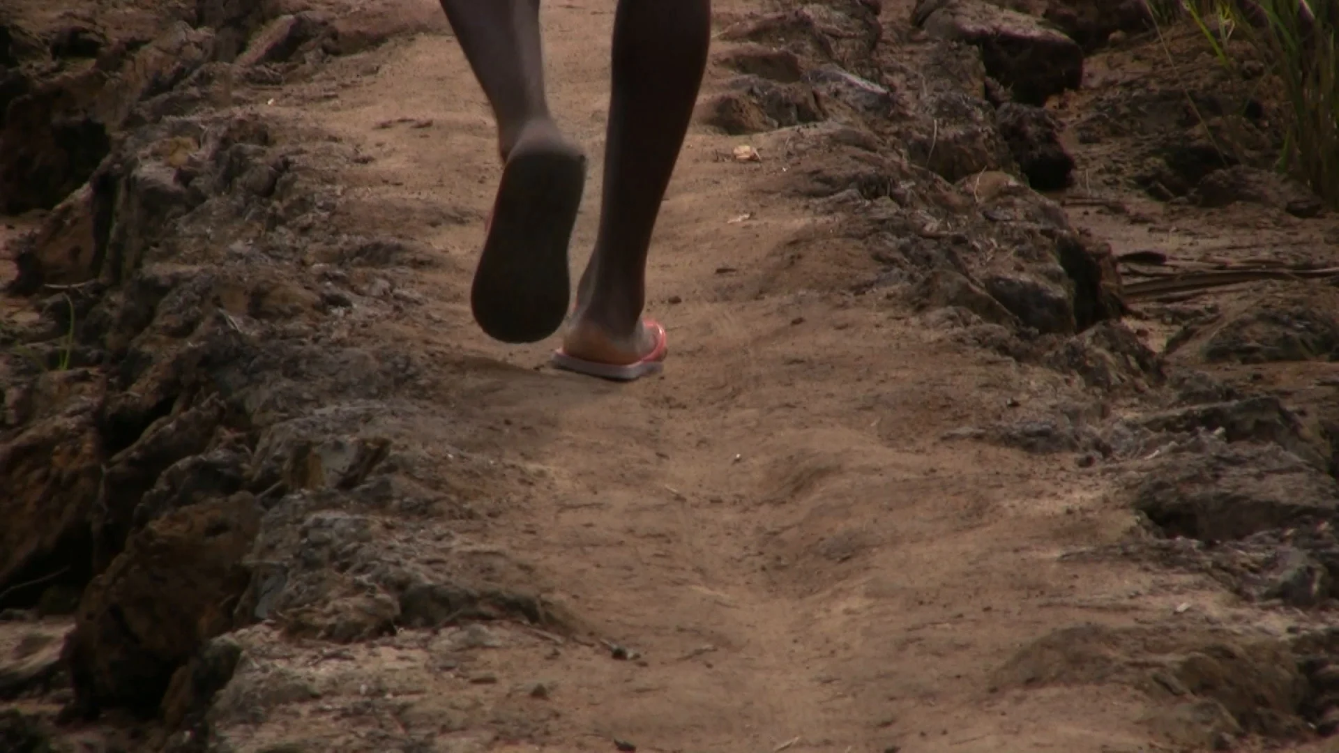 The Dusty Foot On The Road Outlet | emergencydentistry.com