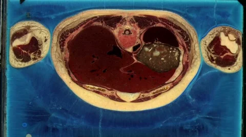 Visible Human Project Stock Video Footage | Royalty Free Visible Human ...