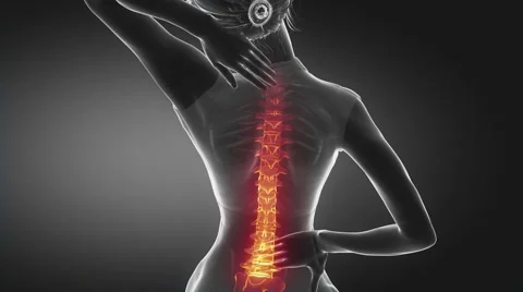 Back Pain Stock Footage ~ Royalty Free Stock Videos | Pond5