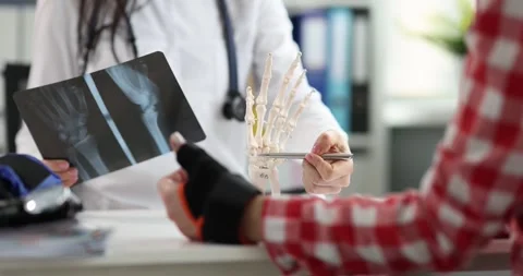 Female doctor reads x-ray with broken ha... | Stock Video | Pond5