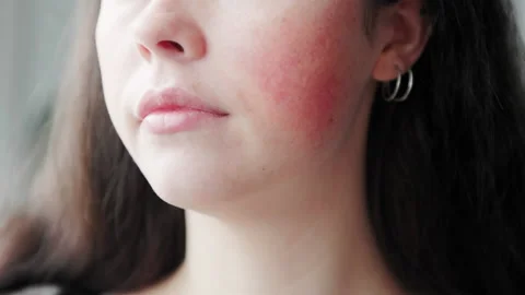 Female Cheeks Stock Video Footage | Royalty Free Female Cheeks Videos ...