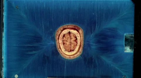 Human Organ Project Stock Videos – Royalty-Free HD & 4K Videos | Pond5