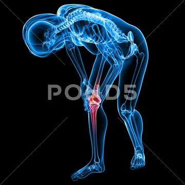 Female knee pain anatomy: Graphic #38801221