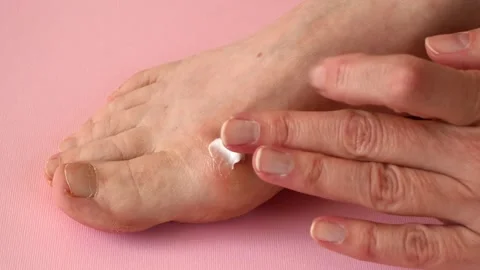 female legs with problem with women's fe... | Stock Video | Pond5