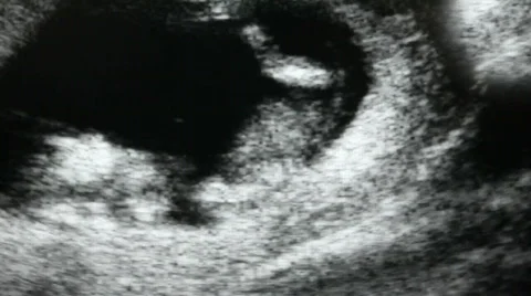 Fetus ultrasound scan | Stock Video | Pond5