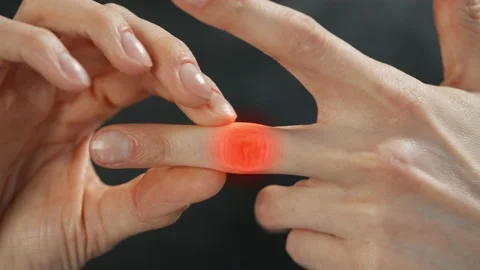 Finger Knuckle Hand Joint Pain | Stock Video | Pond5