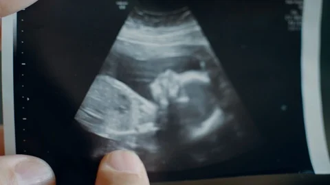 Finger of man caressing baby's ultrasoun... | Stock Video | Pond5