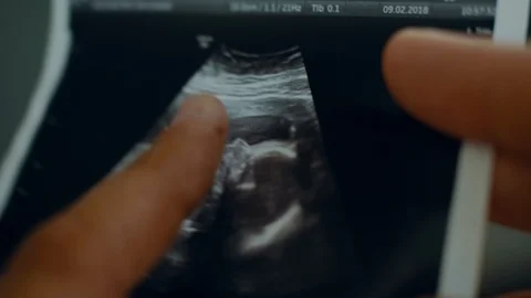 Finger of man caressing baby's ultrasoun... | Stock Video | Pond5