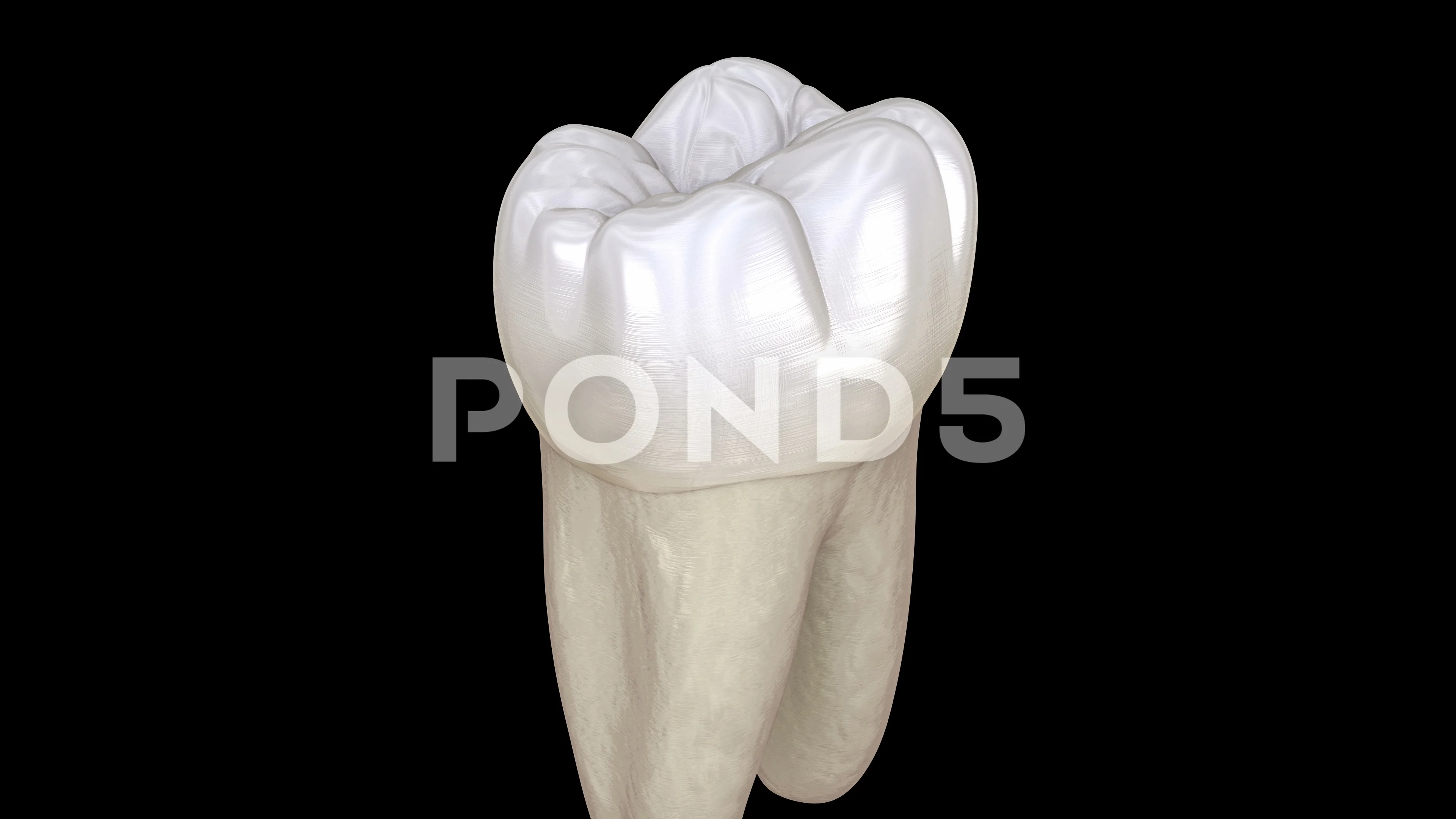 Molar Tooth 3d