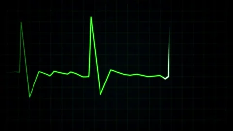 Ekg Flatline Stock Footage ~ Royalty Free Stock Videos | Pond5