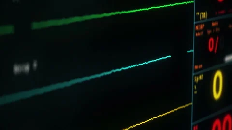 Flatline pulse test graph identifies the... | Stock Video | Pond5