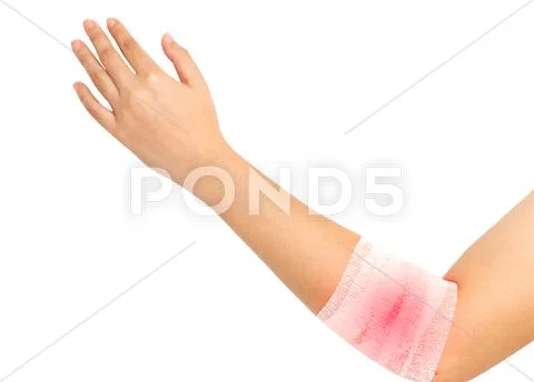 Forearm and elbow injury ,strain ,sprained in white bandage Stock Image ...