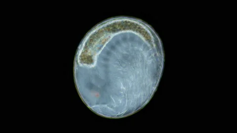Formed embryo in an egg Amphipoda crusta... | Stock Video | Pond5