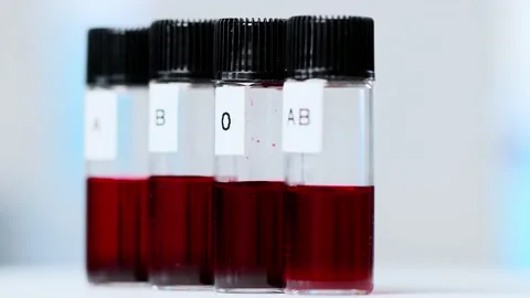 the four blood groups in test tubes | Stock Video | Pond5
