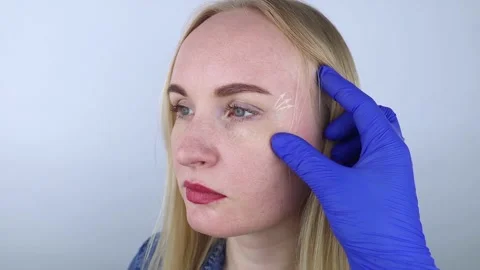 Fox eye lift. Before and after. On left ... | Stock Video | Pond5