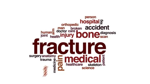 Fracture animated word cloud, text desig... | Stock Video | Pond5