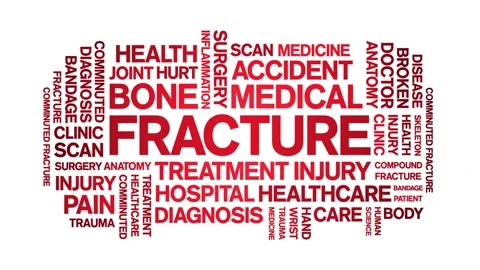 Fracture animated word cloud,animation t... | Stock Video | Pond5