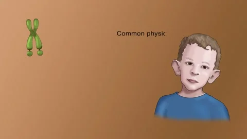 Fragile X and Boy's Face with Text | Stock Video | Pond5