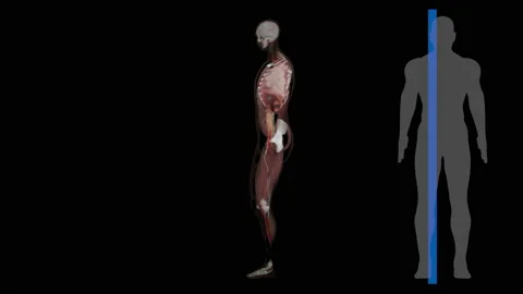 Full-body ct scan with thick slices, lef... | Stock Video | Pond5