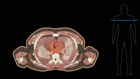 Full body organs MRI scan, or computed t... | Stock Video | Pond5