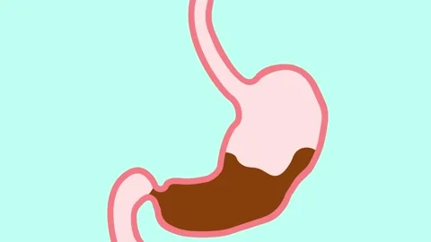 Full stomach. Fluid stomach. Cartoon sto... | Stock Video | Pond5