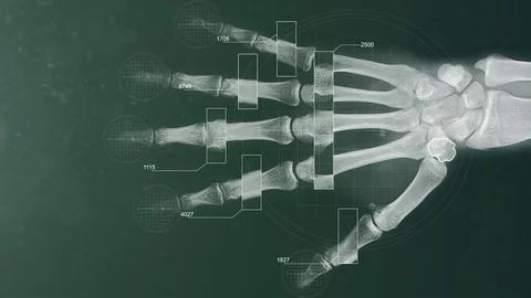 Futuristic Hand X-Ray Scanning and Analy... | Stock Video | Pond5