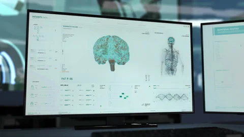 Futuristic Hospital Health Monitoring In... | Stock Video | Pond5