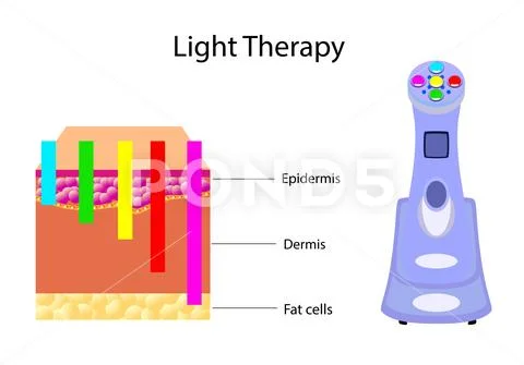 Gadget for Light Therapy and chart, vector illustration ~ Clip Art ...