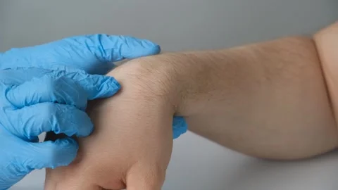 Ganglion cyst or hygroma of the wrist on... | Stock Video | Pond5