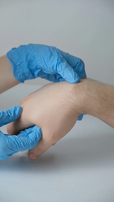 Ganglion cyst or hygroma of the wrist on... | Stock Video | Pond5