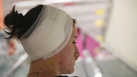 Girl with head injury, ear plastic surge... | Stock Video | Pond5