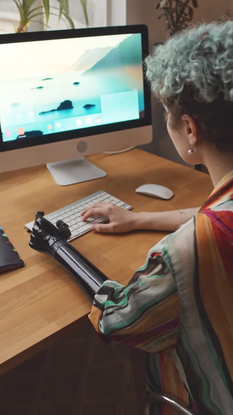 Girl with Prosthetic Arm Typing on Compu... | Stock Video | Pond5