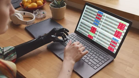 Girl Typing with Prosthetic Arm on Lapto... | Stock Video | Pond5