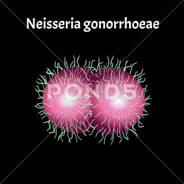 Gonococcus structure. Neisseria gonorrhoeae. Gonorrhea disease ...
