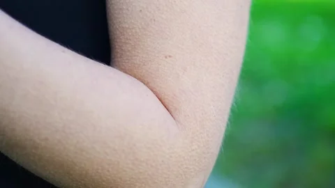 Goosebumps Female Stock Videos – Royalty-Free HD & 4K Videos | Pond5