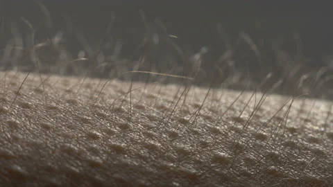 Goosebumps macro. Hair on the hand rise ... | Stock Video | Pond5