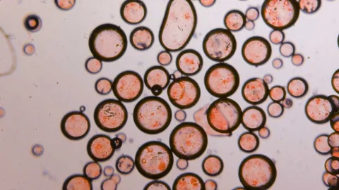 grains like the eggs under the microscop... | Stock Video | Pond5