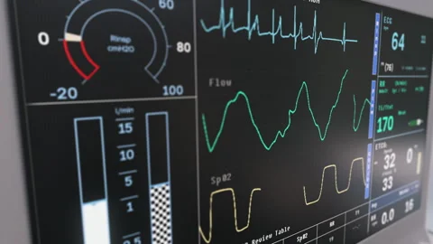 Graph On Electronic Monitoring Medical E... | Stock Video | Pond5