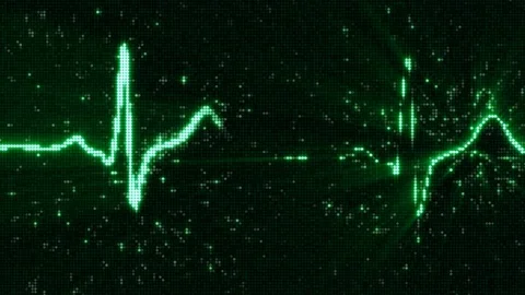 Green Ekg Stock Footage ~ Royalty Free Stock Videos | Pond5