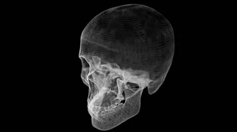 Grid of Human Skull | Stock Video | Pond5