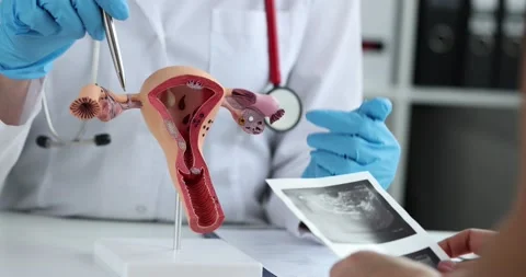 Gynecologist shows the anatomy of uterus... | Stock Video | Pond5