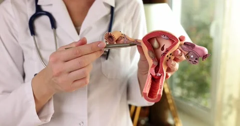 Gynecologist shows structure of uterus o... | Stock Video | Pond5