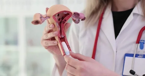 Gynecologist teaches process of insertin... | Stock Video | Pond5