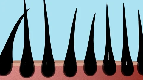 Hair Growth Animation Stock Videos – Royalty-Free HD & 4K Videos | Pond5